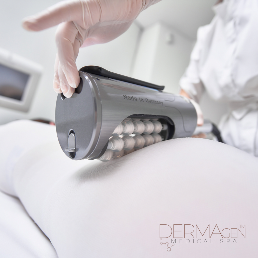 DERMA GEN MED SPA – DERMAGEN MED SPA
